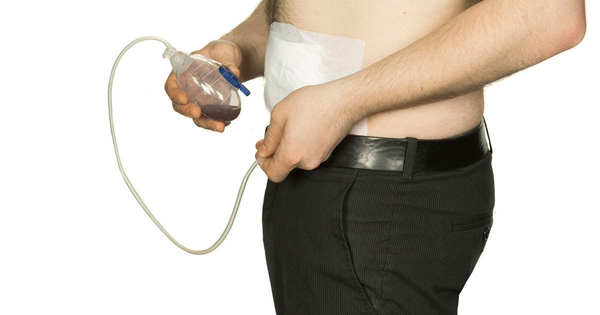 Taking Care Of A drain After Surgery